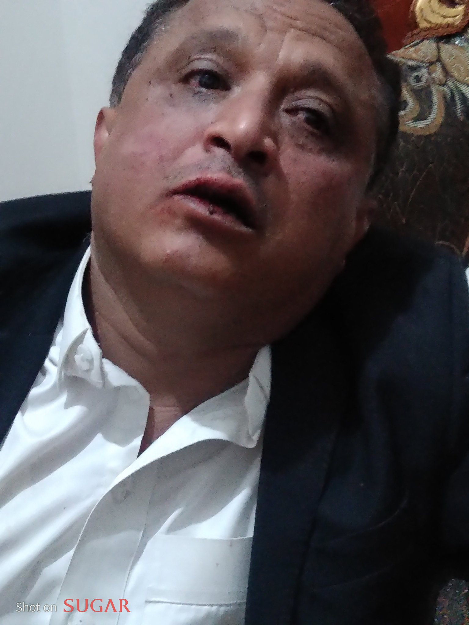 Statement condemning the assault on journalist Mojali Al-Samadi in Sana ...